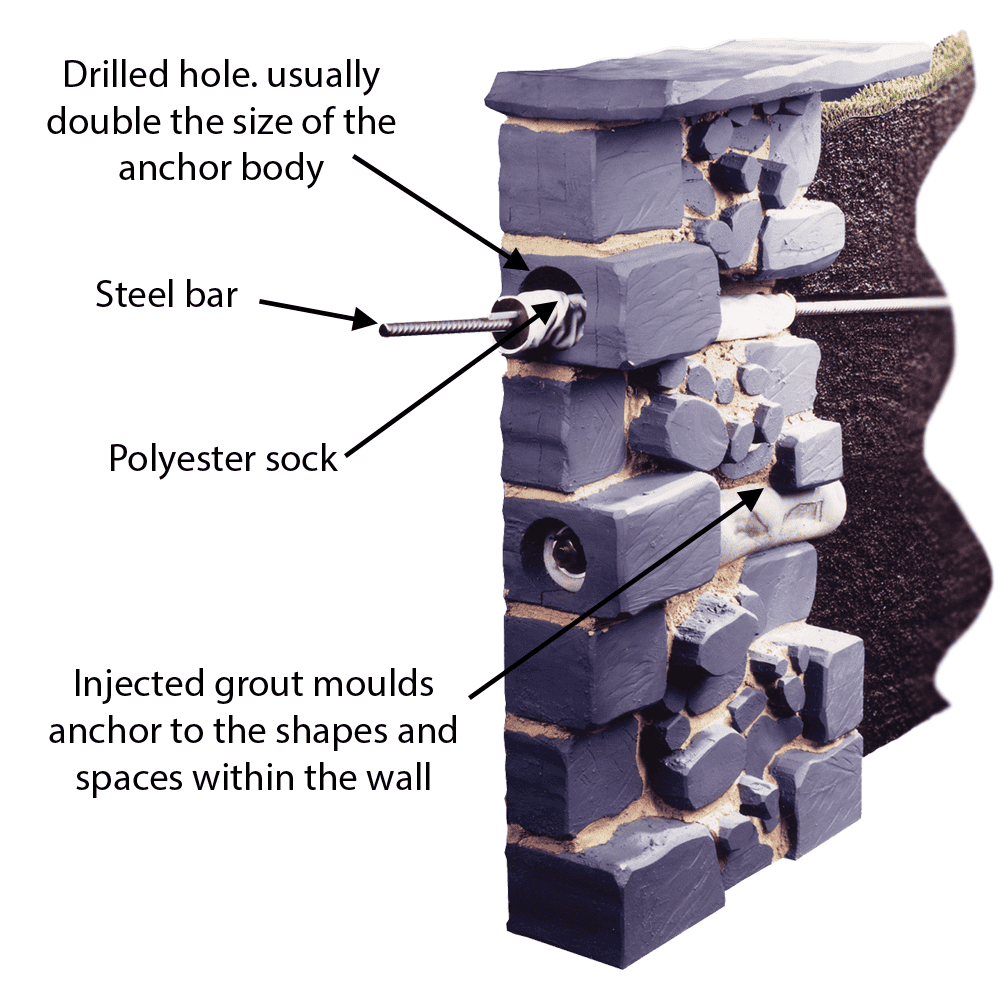 Cintec Sock Anchor System | Advanced Structural Repairs: ASRS